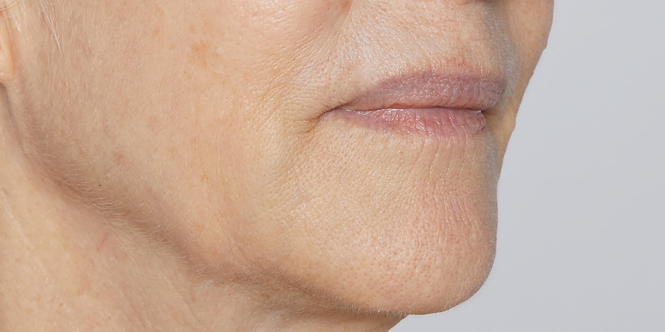 Cell Forté Serum | Human Stem Cell Skincare | Exosomes