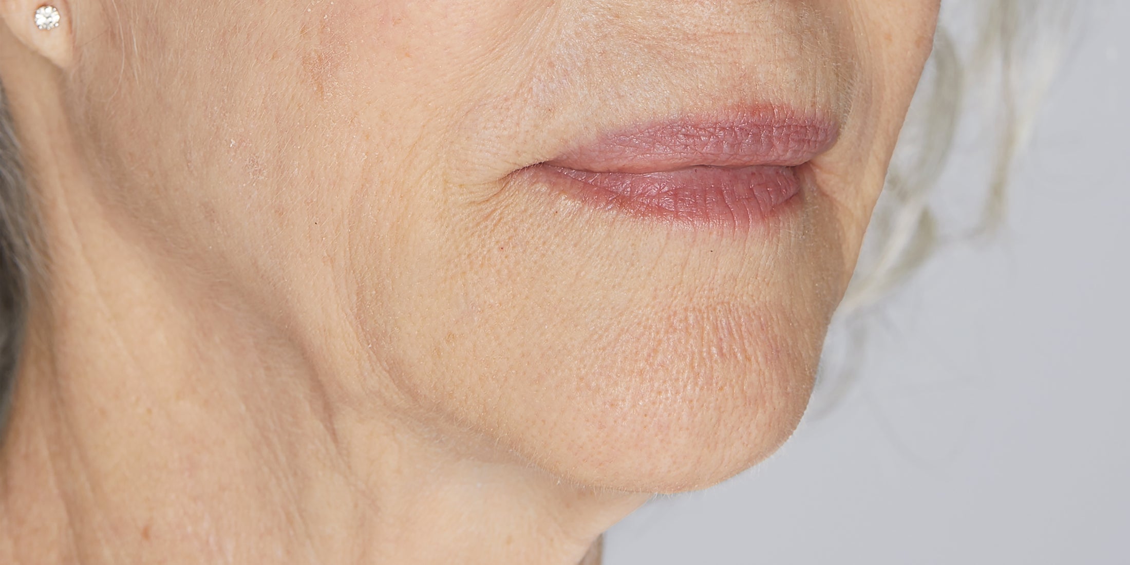 Cell Forté Serum | Human Stem Cell Skincare | Exosomes