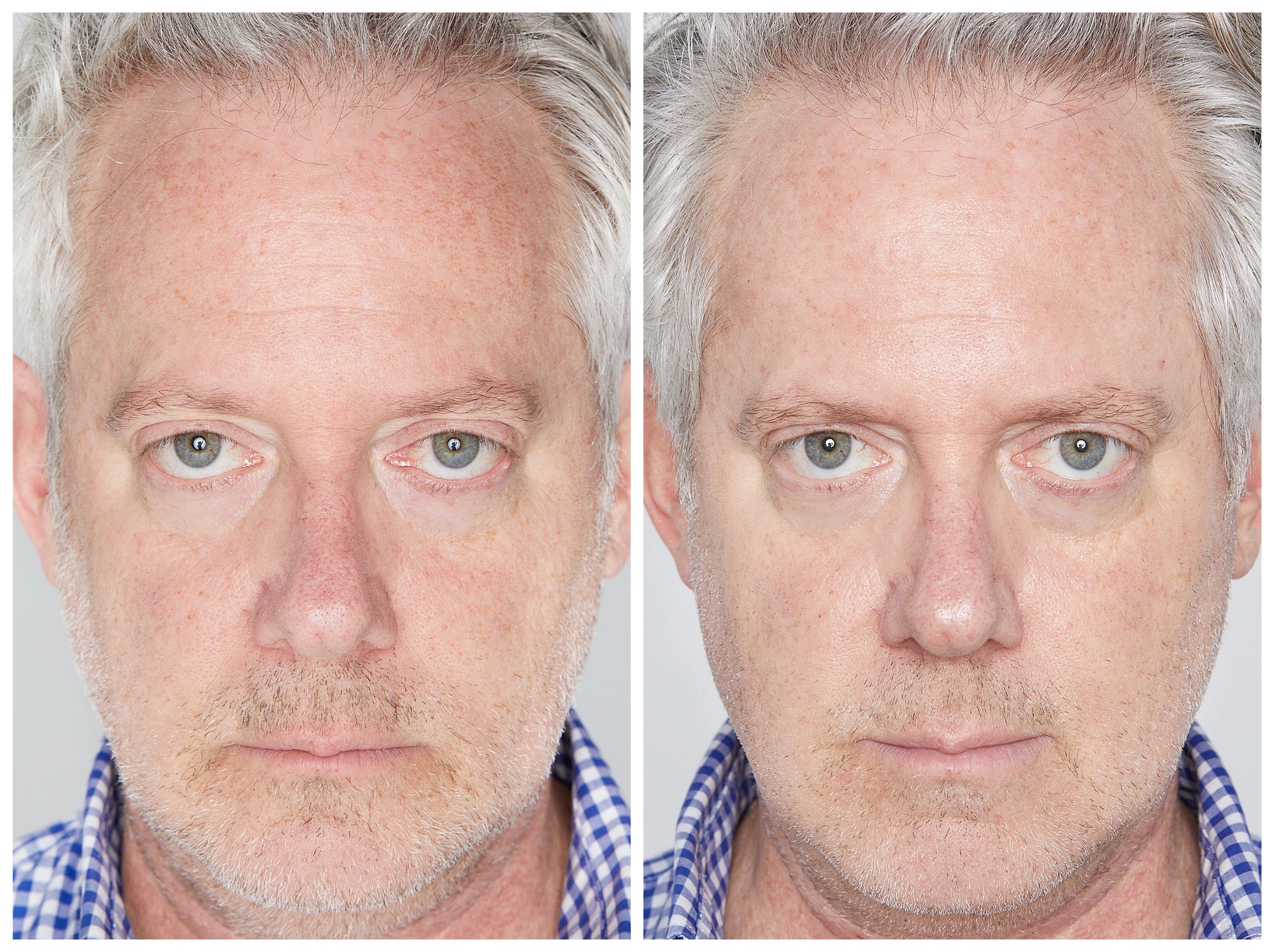 Cell Forté Serum | Peptides | Exosomes